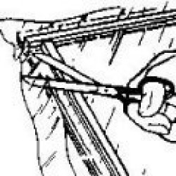 Tyz-all Interior Storm Weather Window Systems 50 Prices | Shop Deals ...